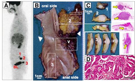 Formalin Fixed Specimens Obtained At The Time Of The Secondary Download Scientific Diagram