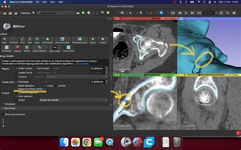 Trouble With Extension Surfacewrapsolidify Support 3d Slicer Community