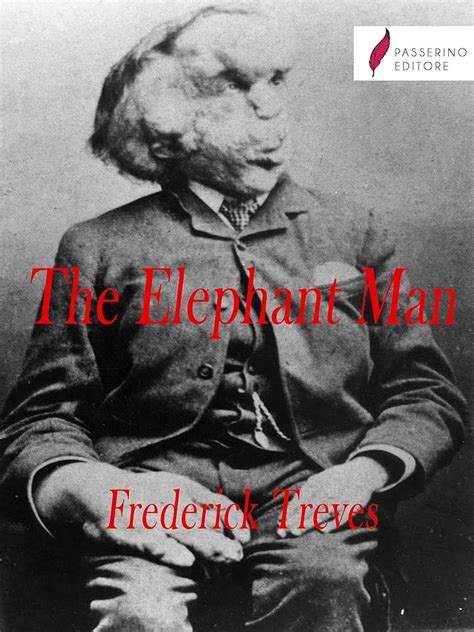 The Elephant Man John Merrick