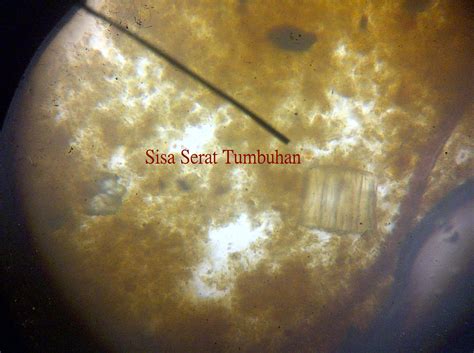 Rizqi Murtafi Ah Pemeriksaan Feses Lengkap Rizqi Murtafi Ah Pemeriksaan Feses Lengkap