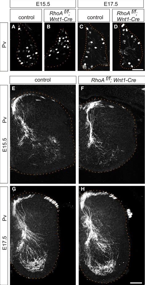 Proprioceptive Sensory Neurons And Proprioceptive Axonal Projections In