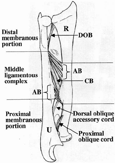 The Triangular Fibrocartilage Complex Tfcc Photo Graphed From The Download Scientific