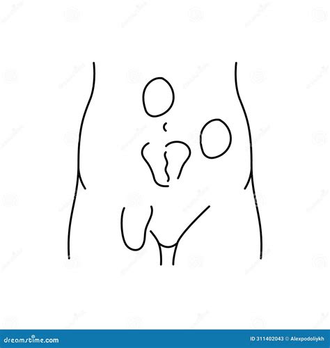Hernias Line Icon Vector Isolated Element Stock Vector Illustration Of Intestine Operation