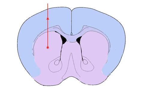 α Synuclein Preformed Fibril Pff Parkinsons Models