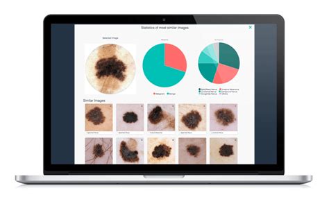 Dermengine Visual Search