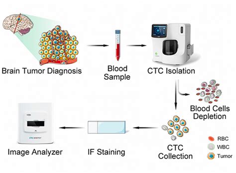 Use Of Circulating Tumor Cells And Microemboli To Predict Diagnosis And Prognosis In Diffuse