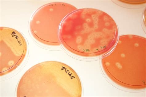 Researchers Find Strep As Achilles Heel With Potential Vaccine To Prevent Rheumatic Heart