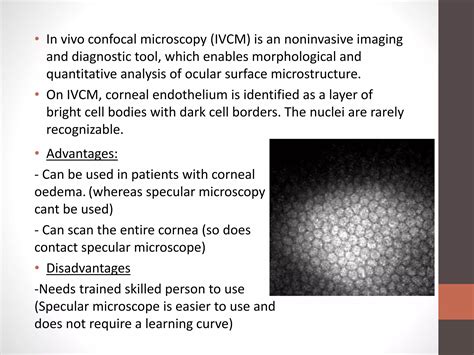 Assessment Of Corneal Endothelium Pptx