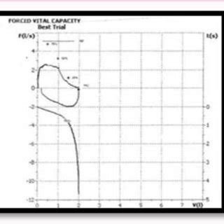 Flow Volume Curve Of Patient Before Treatment Download Scientific Diagram