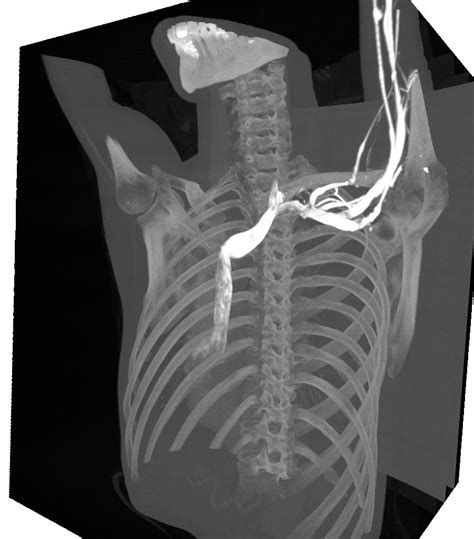 Using Fast On Mri And Ct Images In Python Fast Documentation