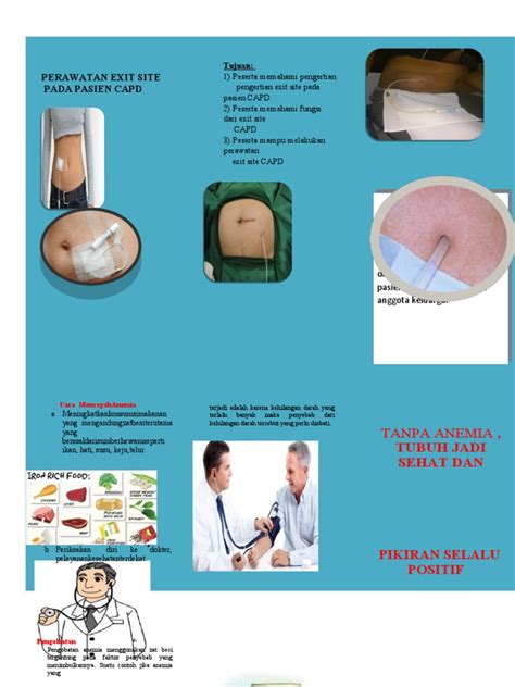 Leaflet Capd Pdf