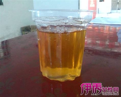 尿的颜色很深 癌症尿液深褐色 随意云