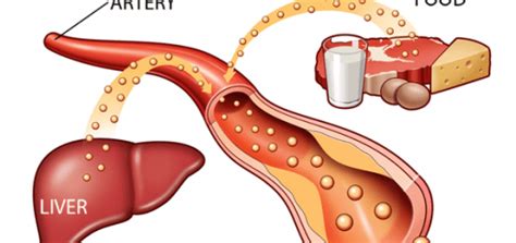 Chromosomal Disorders Structure Classification And Types Of Numerical Chromosomal