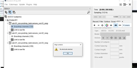 SEEG Epileptogenicity Maps Tutorial Discussions Brainstorm