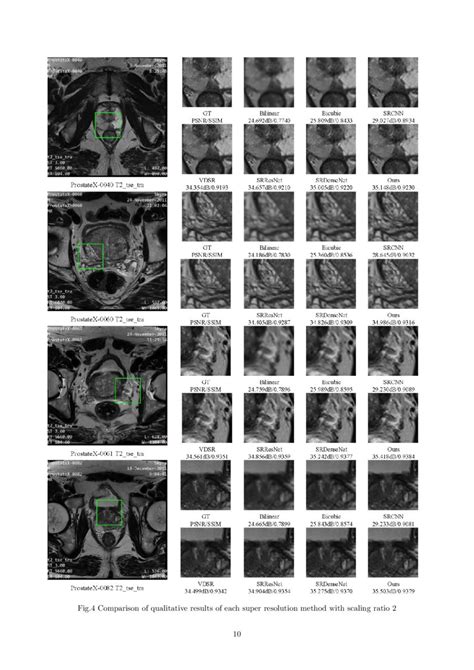 Medical Image Super Resolution Method Based On Dense Blended Attention Network Deepai