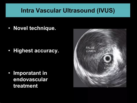 Type B Aortic Dissection Pptx