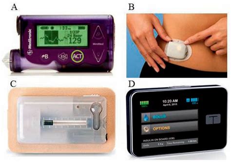 Improving Diabetes Care With Technology And Information Management Pmc
