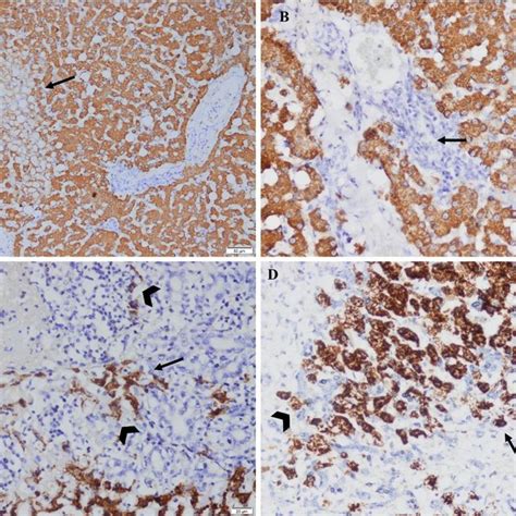 Human Hepatocyte Marker 1 Hep Par 1 Staining In Various Feline