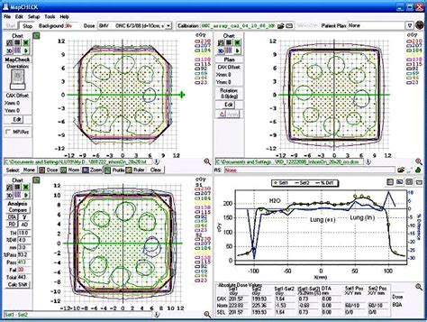 Comparison Of Measured Dose With Calculated Dose Using Aaa Download Scientific Diagram