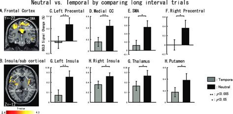 Neutral Task Vs Temporal Task By Comparing Long Interval Trials
