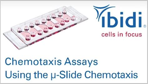 Methods To Analyze Chemotaxis Recent Studies Explained