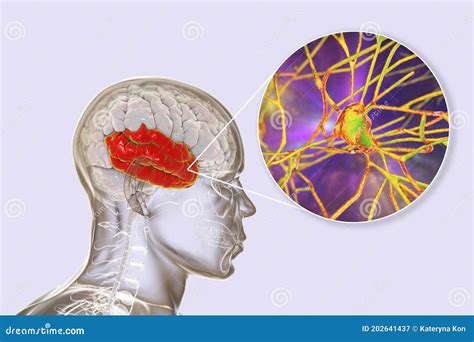 Human Brain With Highlighted Temporal Lobe And Close Up View Of Neurons Royalty Free Cartoon