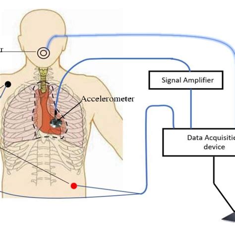 Segmentation Of The Scg Signal Using Ecg Beats Download Scientific Diagram