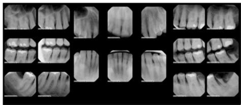 Lecture 2 New Classification For Periodontal And Peri Implant Diseases