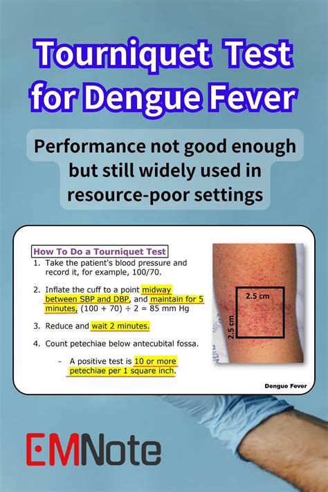 How To Perform A Tourniquet Test For Dengue Fever Rfoamed911
