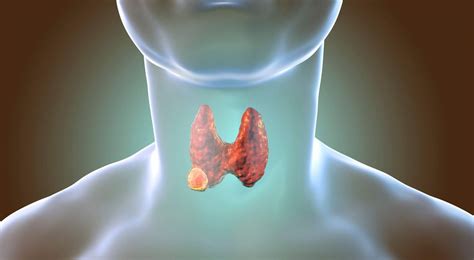 Can A Thyroid Issue Cause Dizziness The Link Between Thyroid And Equilibrium