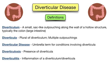 Diverticulosis And Diverticulitis Guide Causes Symptoms