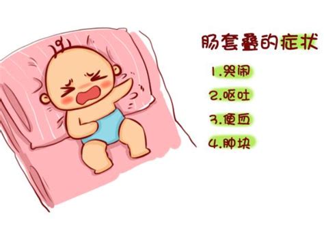 肠套叠症状 肠套叠b超图片 大山谷图库