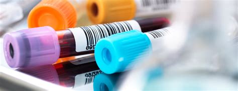 Complement Component 3 C3