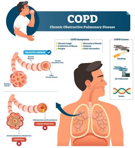 Copd