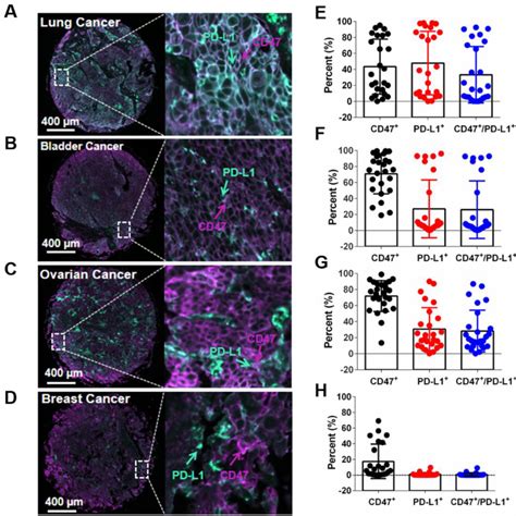 Detection Of The Co Expression Of Cd47 And Pd L1 In Different Types Of Download Scientific