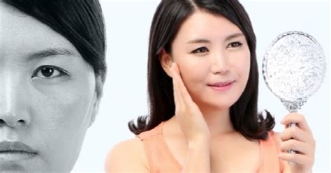 광대뼈·사각턱 안면윤곽수술 회복기간 길다는 말 사실은