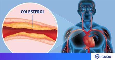 Lanzaron Un Medicamento Para Bajar El Colesterol Hecho En Argentina