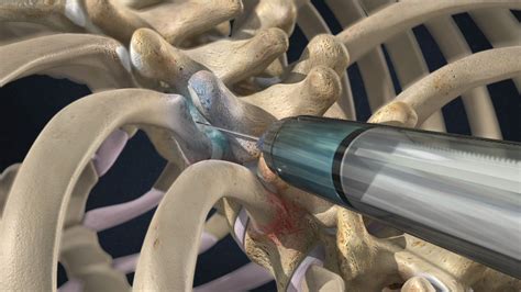 Costotransverse Joint