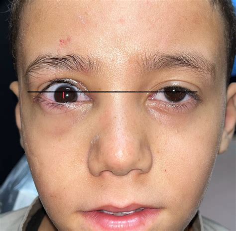 Set A Reference Line Permanently Image Analysis Image Sc Forum