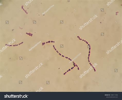 Chracteristic Gram Positive Cocci Chains Streptococcus Foto Stok
