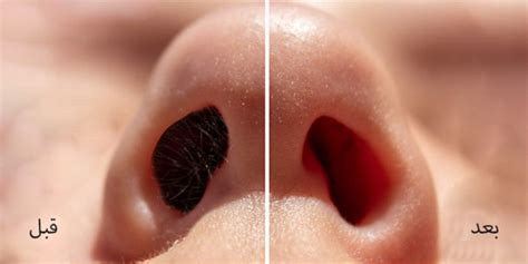 چگونه موهای بینی خود را به راحتی و بدون درد از بین ببریم؟ چند راهکار ساده چی بپوشم