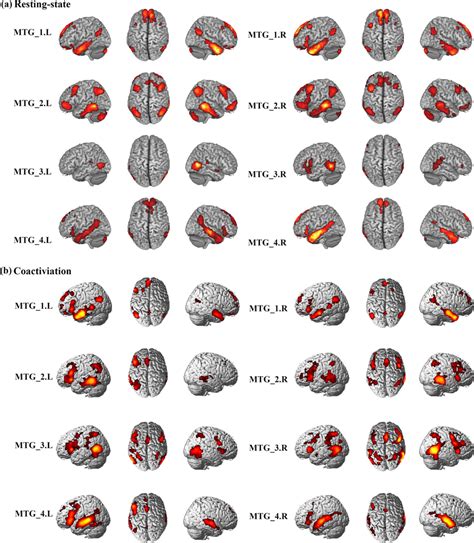 Whole Brain Resting‐state Functional Connectivity Rsfc And