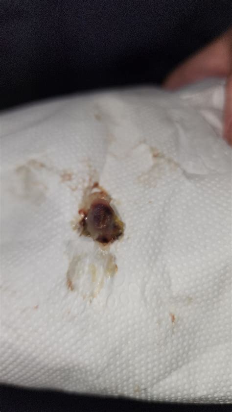 Sorry If This Doesnt Belong Here Not Sure If Its Popping But It Just
