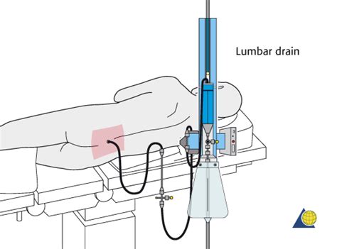 Lines Leads And Drains In The Icu — In The Icu With Jessie Franco