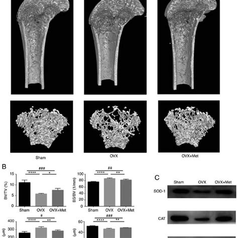 Met Attenuates Bone Loss In Ovariectomized Mice A 3 Dimensional