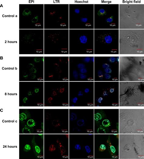 Fluorescence Colocalization Assay By Confocal Microscopy To Determine Download Scientific