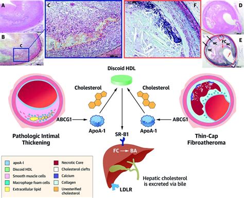 Enhancing Hdl Function To Prevent Atherothrombosis Cvpath Institute