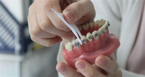 Dental Floss With Braces Easy Techniques