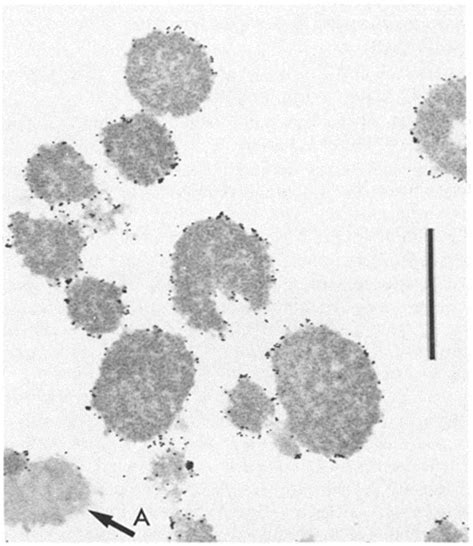 Immunogold Staining Of Globular Loop Using Nucleoplasrain Antibody Download Scientific Diagram