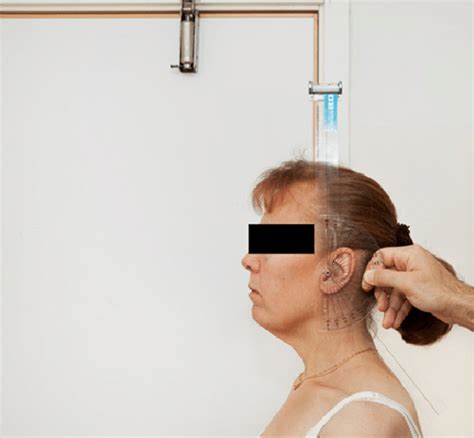 Goniometer Position In Measurement Situation Download Scientific Diagram